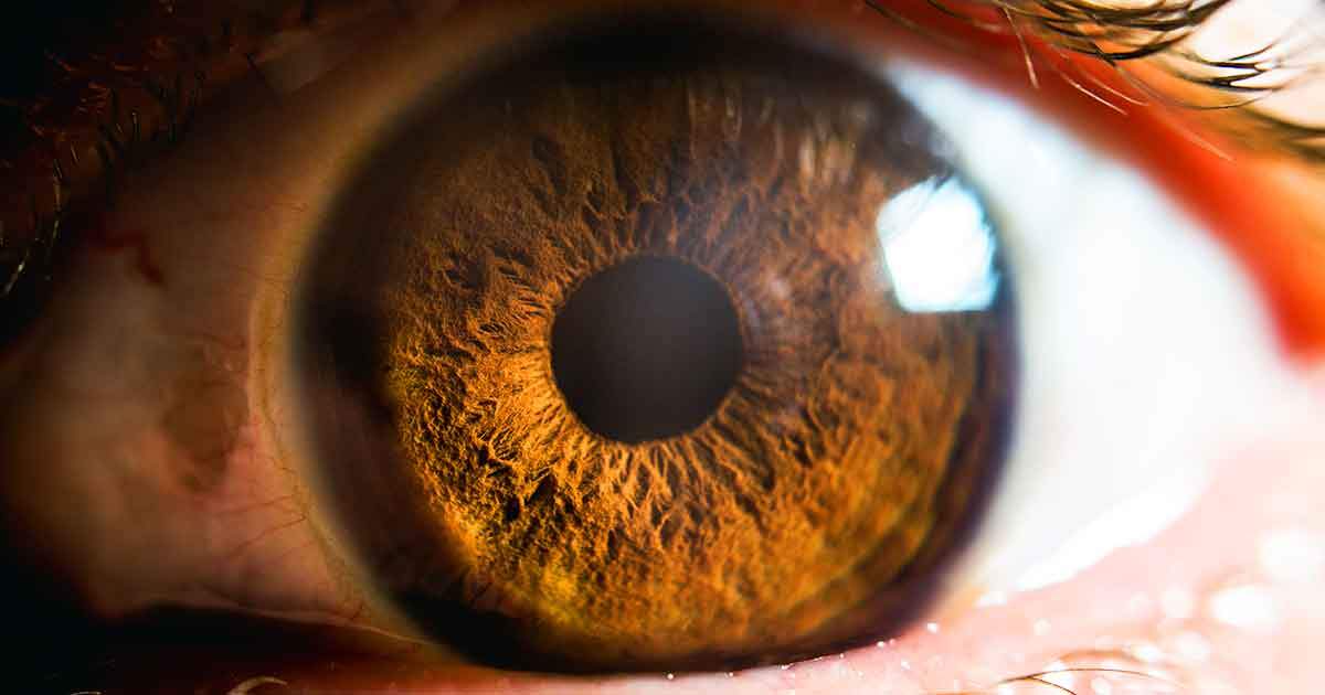 What Is the Meaning of "Pluck Out Your Eye"? | Christian Courier