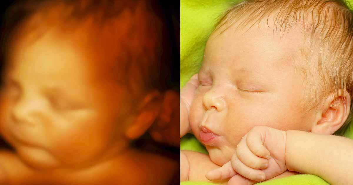 Scientific Evidence Affirms the Worth of Preborn Children | Christian ...